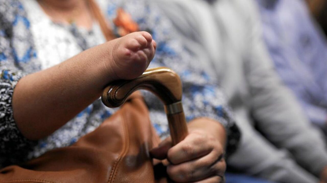 El Gobierno aprobará ayudas para 130 víctimas de la talidomida, el ...