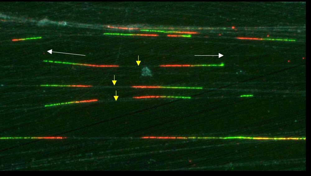 Investigadores españoles descubren la clave para evitar que el ADN se ...