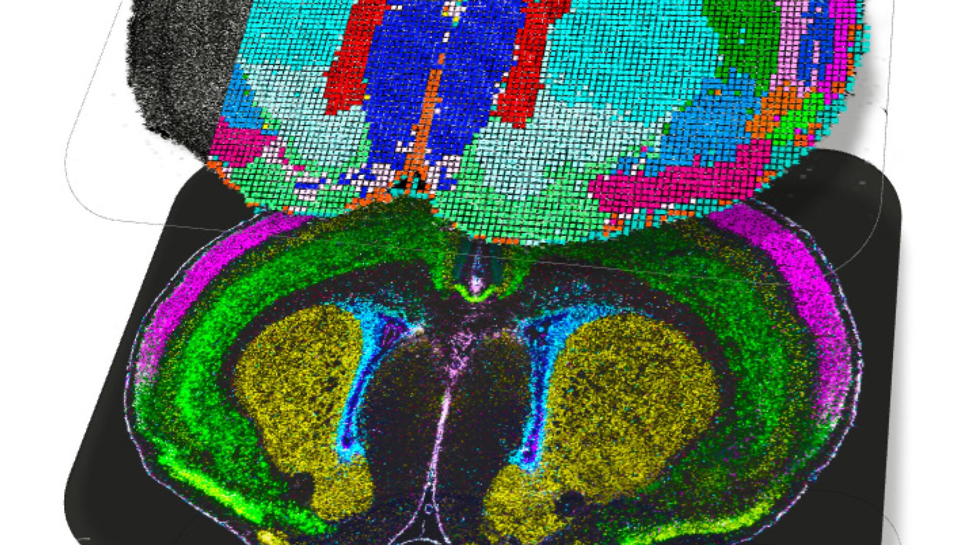 El mapa más completo del cerebro revela cuándo y cómo se forman las ...
