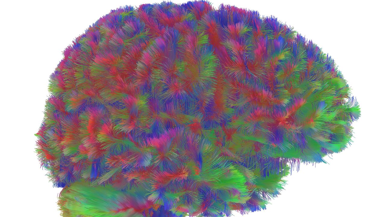 Descubren que el cerebro pasa por cinco fases a medida que envejecemos ...