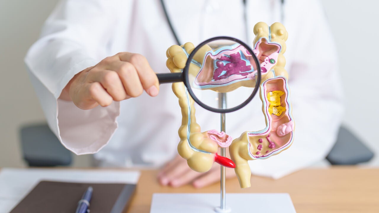 El cáncer vuelve a ser la primera causa de muerte en España